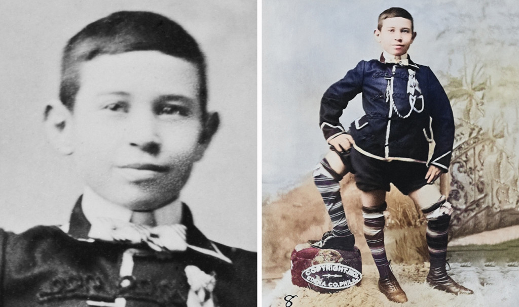 The Extraordinary Life Of The Three-Legged Man - HistoryExpose